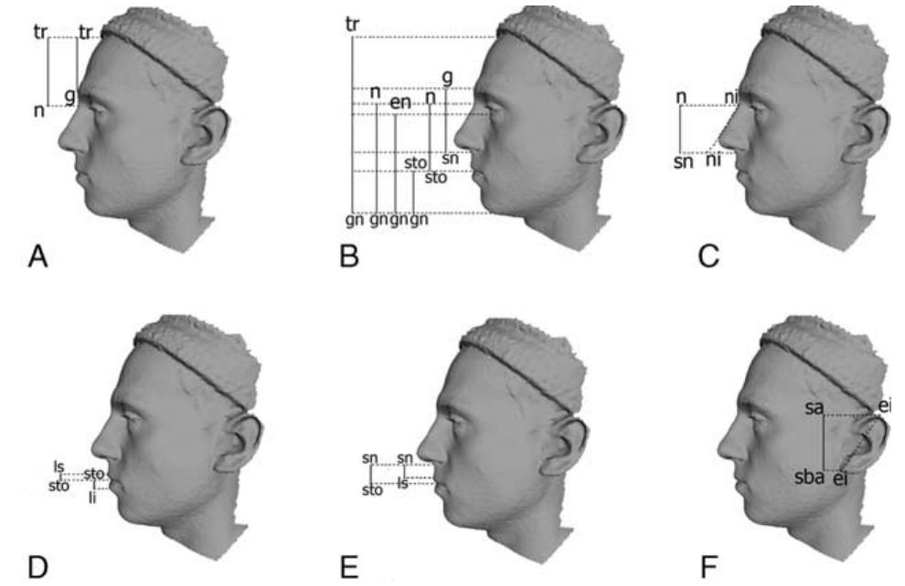 Figure 2 - from Anthropometric Analysis of the Face