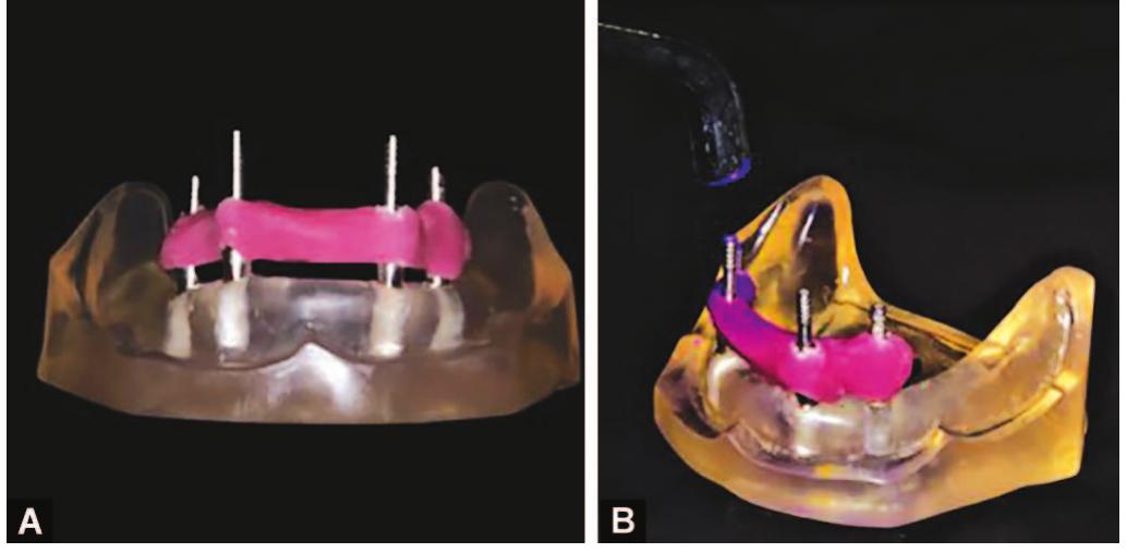 S 6a and b: splinting technique for group d figs 5atoc: