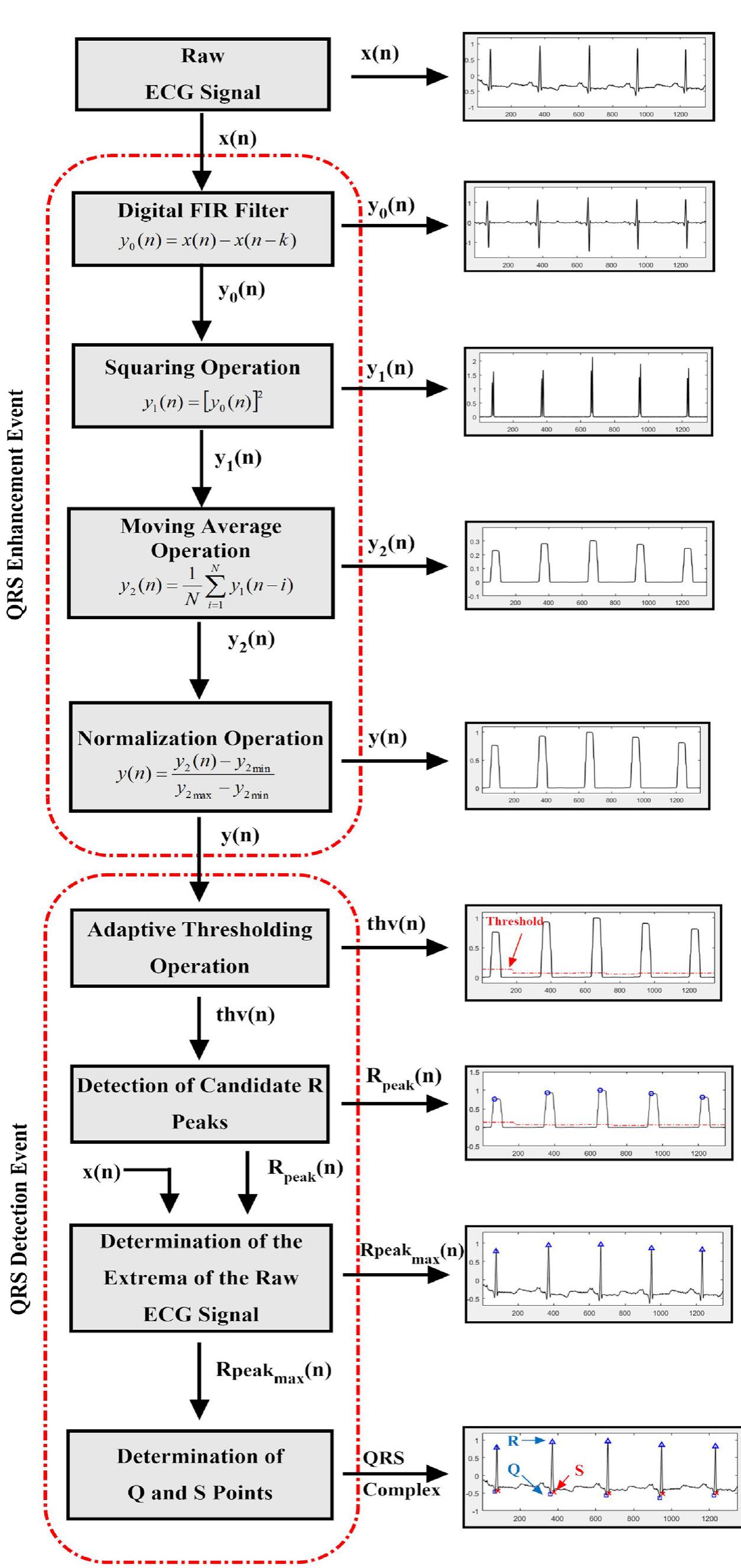 Schematic diagram of the qrs complex detection process