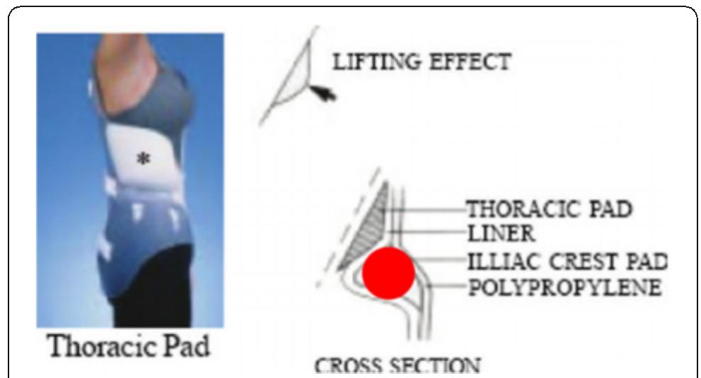 Crest roll between lumbar pad and iliac crest elastic cloth