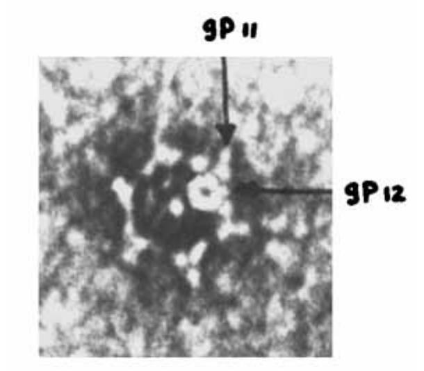 Superposition of one of the spherical structures observed in