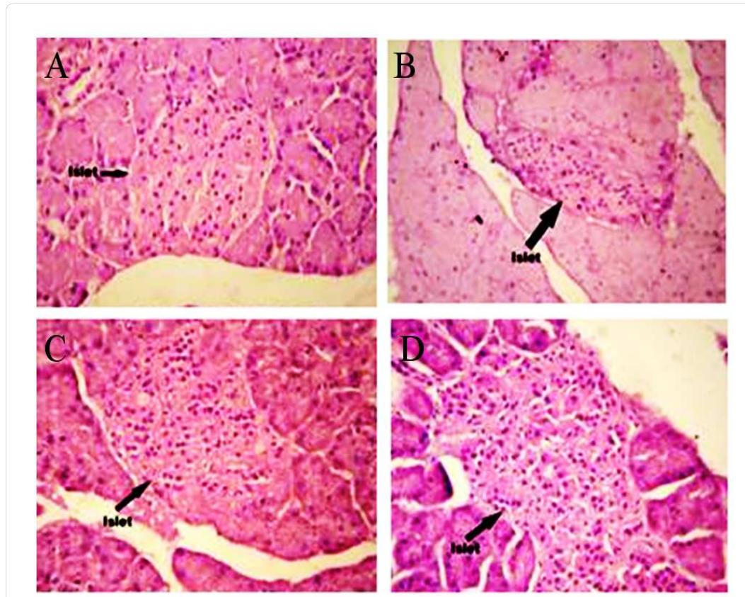 Histopathology of pancreas showing variation in islet