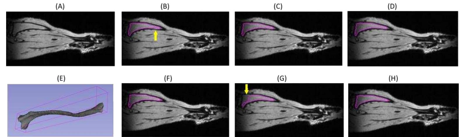 Examples of mouse tibia segmentation contours (magenta) for
