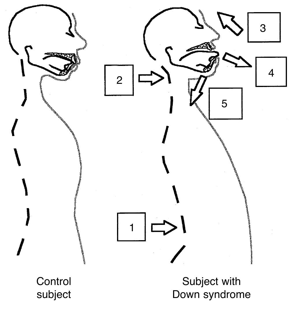 Effect of dorsal and cervical muscle weakness on posture and