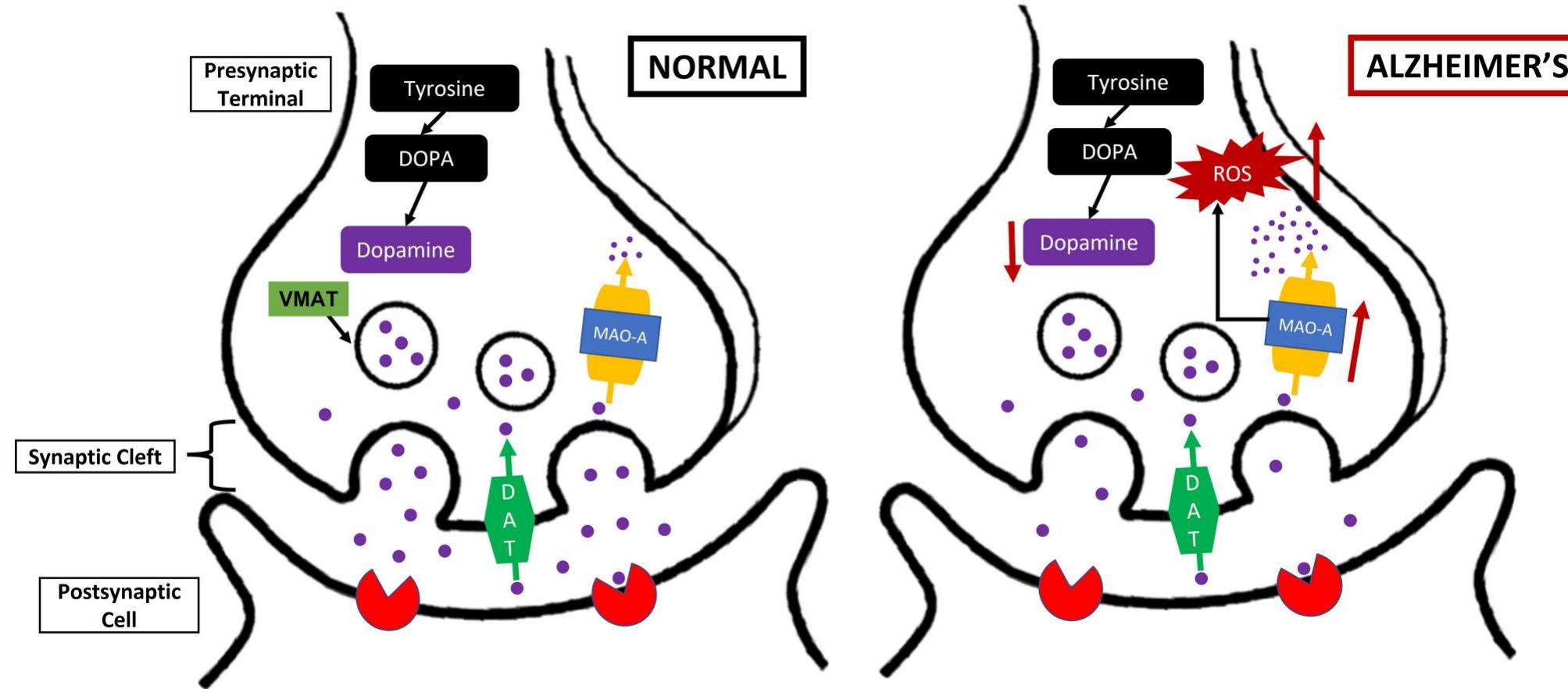 Normal dopamine pathway flow in healthy individuals (left)
