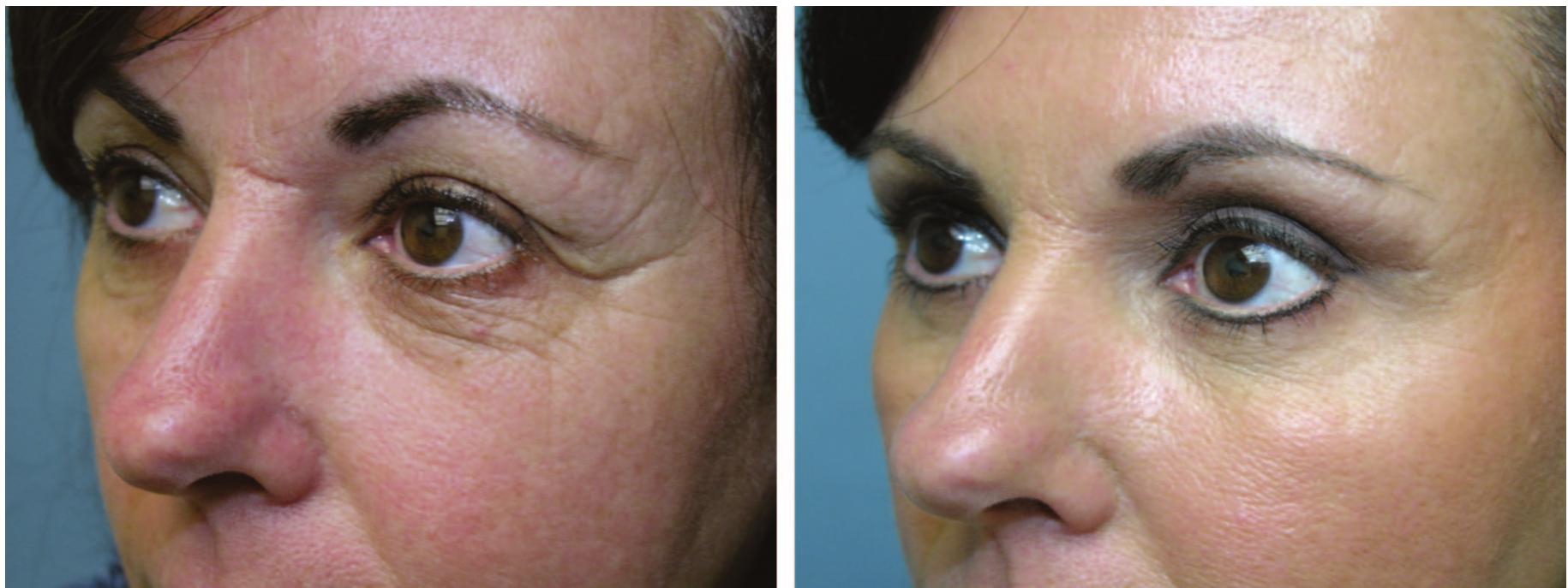 (left) this 47-year-old patient presented for