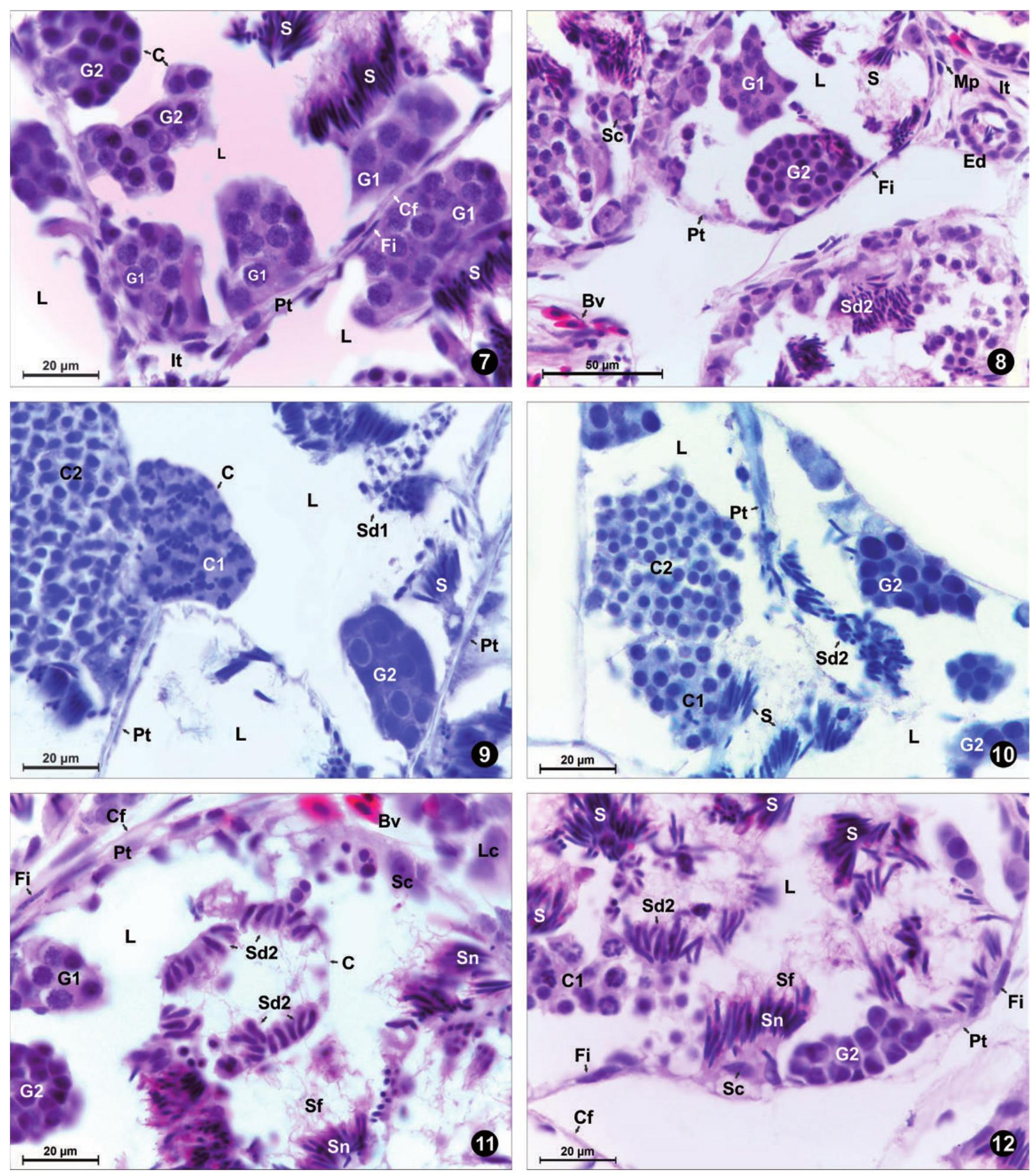 Testicular histology and spermatogenesis of l. /jatinasus.