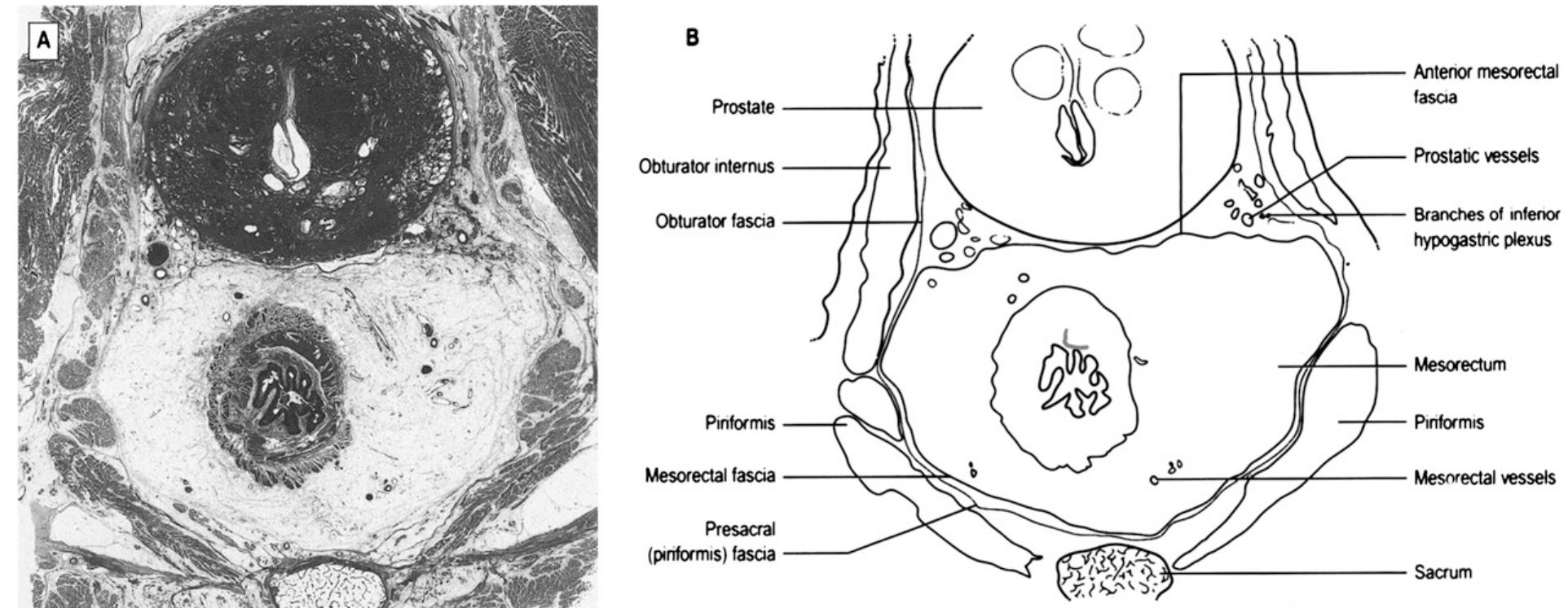 Fic. 8. whole-mount cadaveric specimen of the mid rectum in