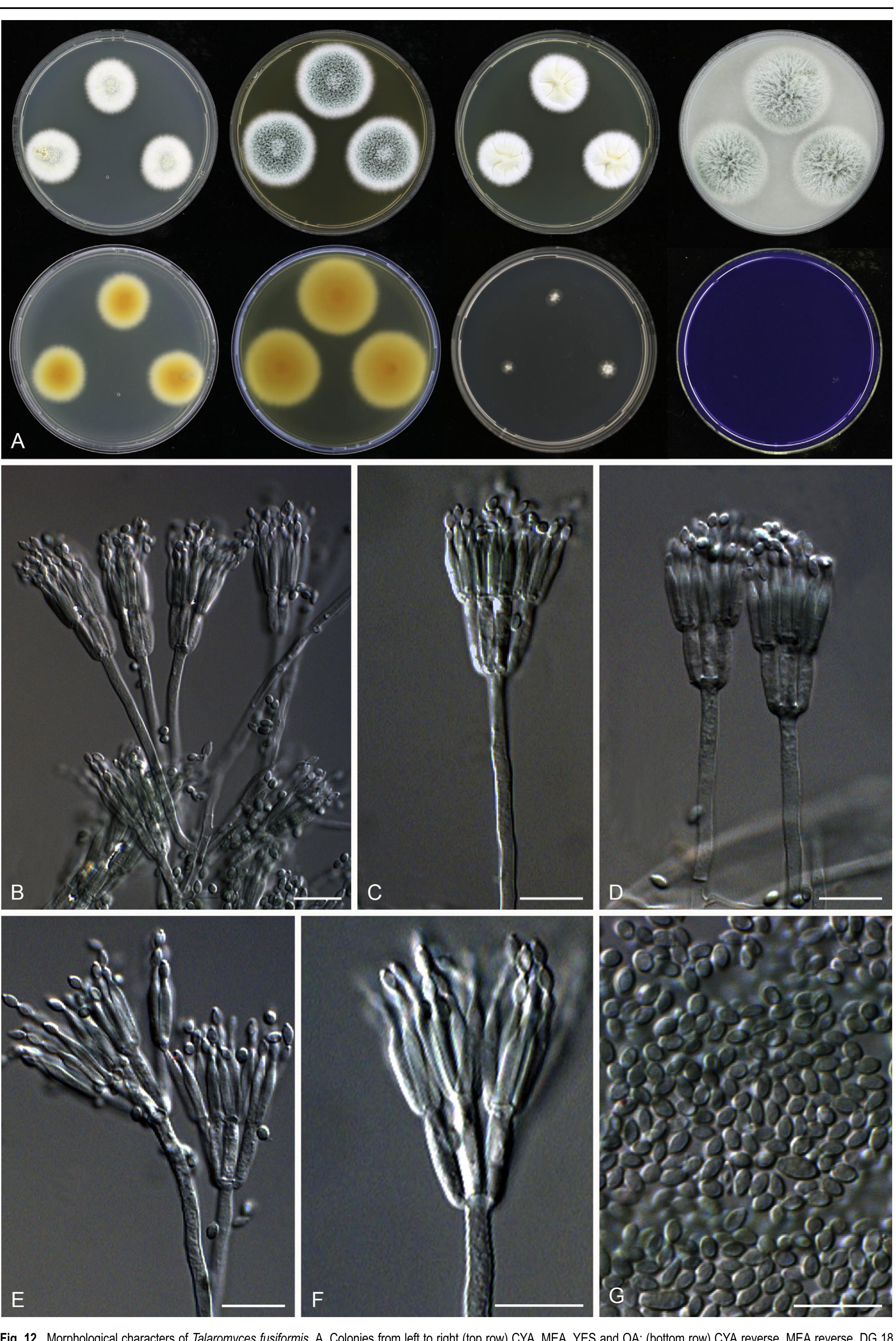 Figure 14 - New Talaromyces species from indoor environments