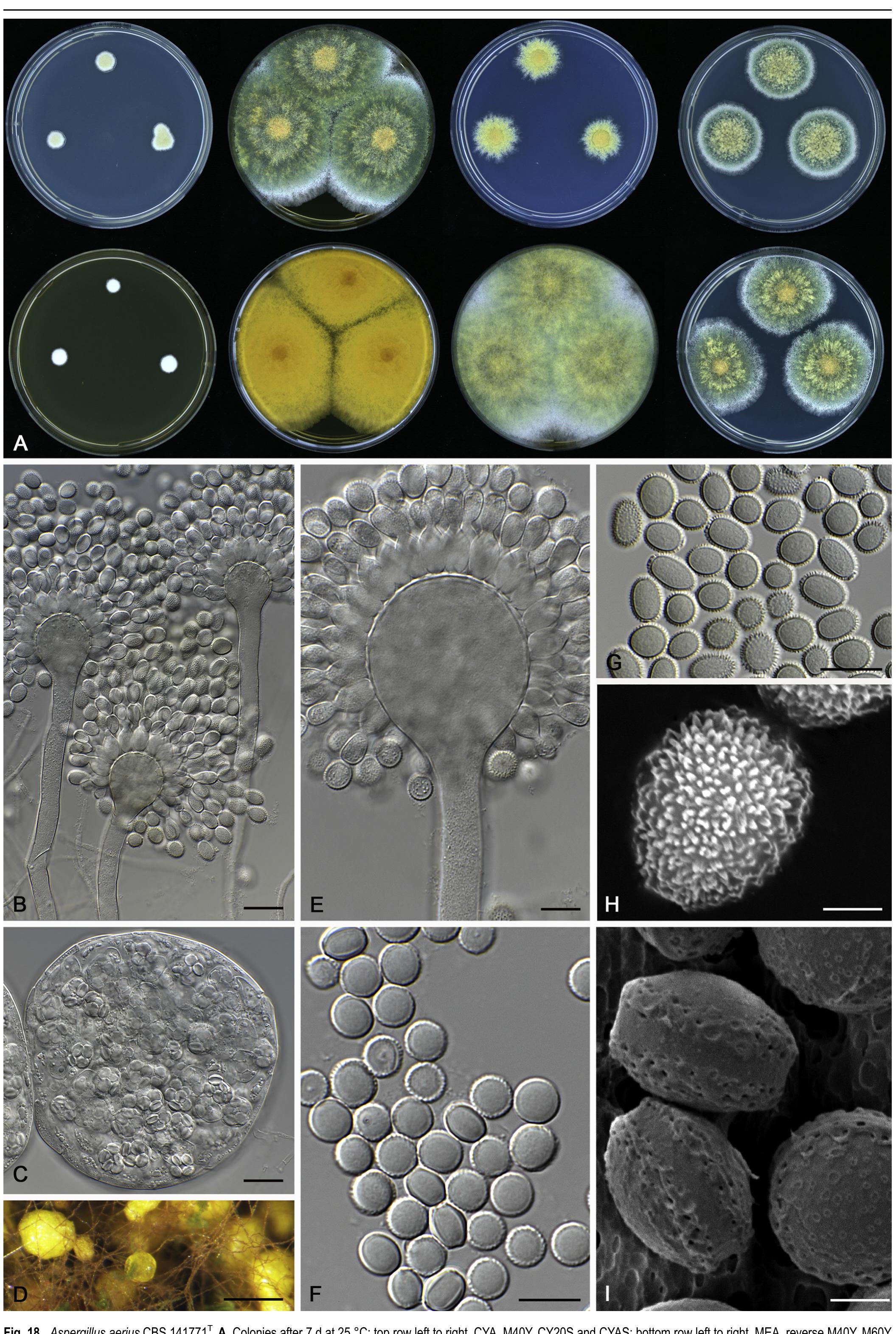 Figure 22 - Polyphasic taxonomy of Aspergillus