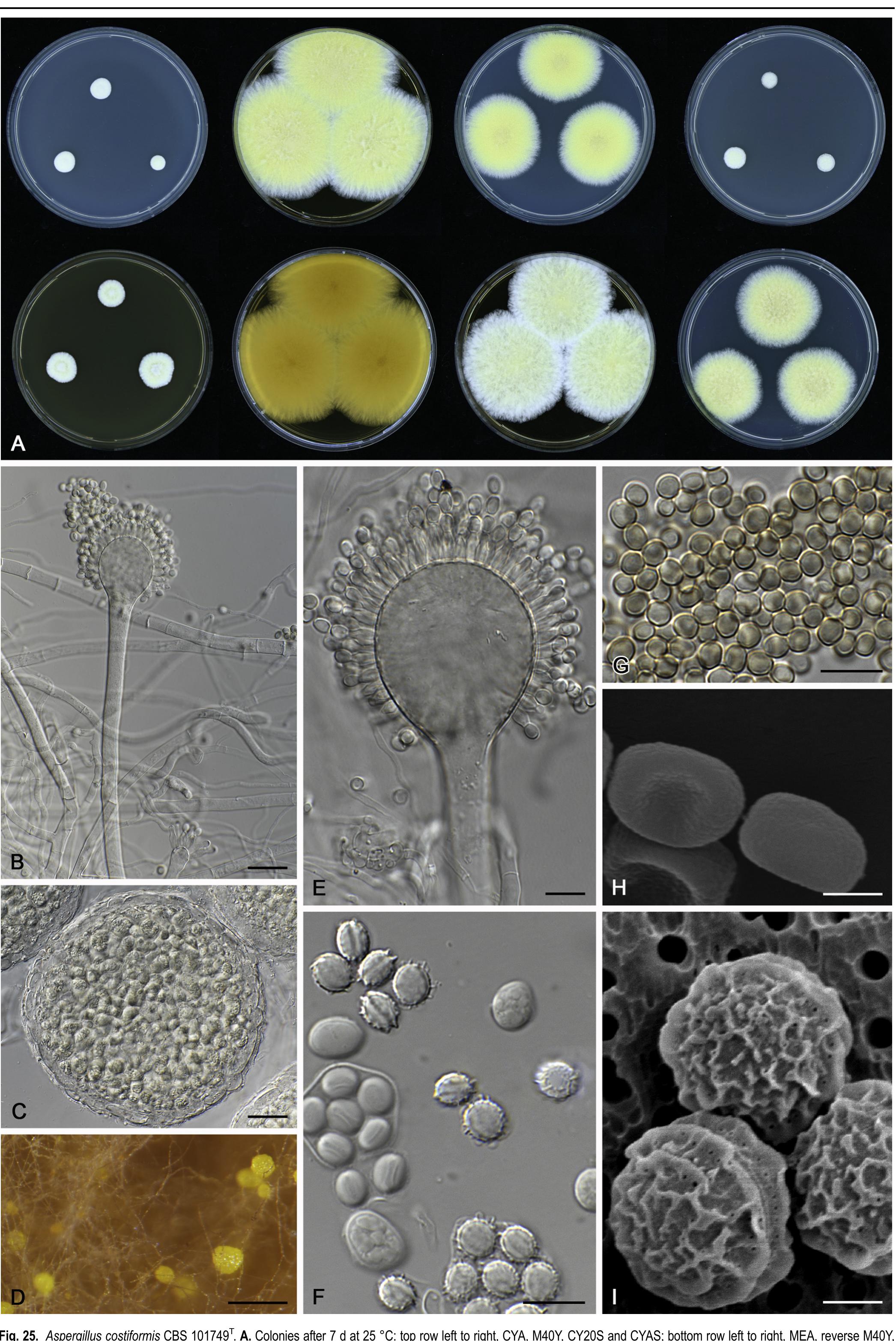 Figure 29 - Polyphasic taxonomy of Aspergillus