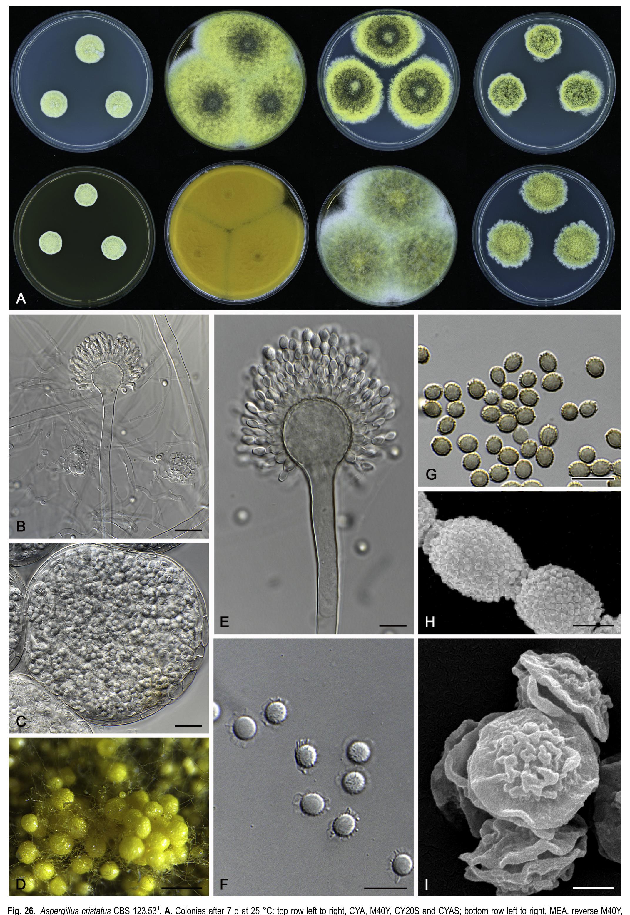 Figure 30 - Polyphasic taxonomy of Aspergillus
