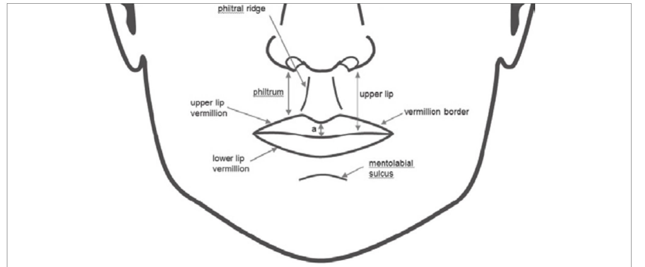 Important anatomical landmarks of the lips.