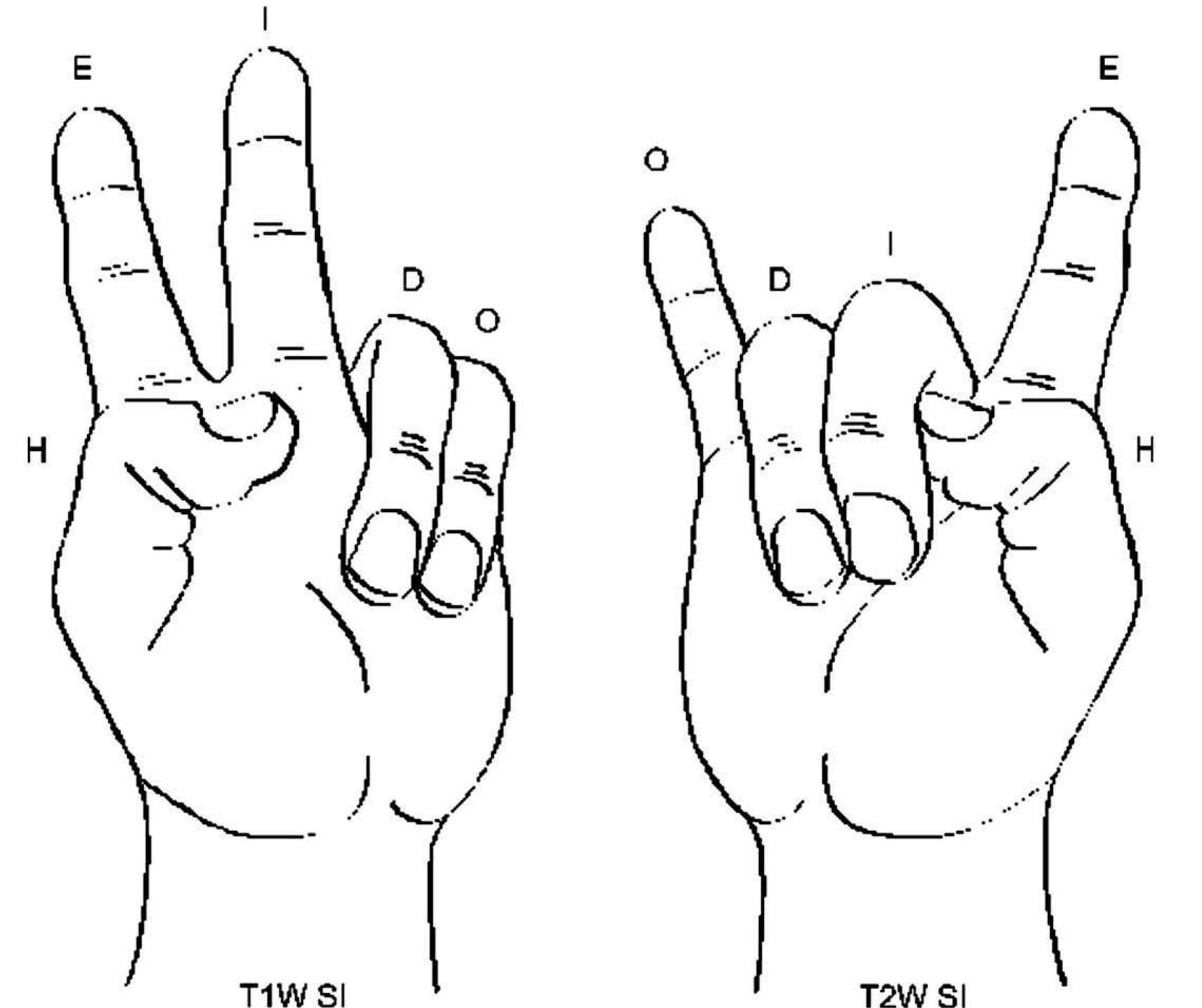 (PDF) Easy Ways to Remember the Progression of MRI Signal Intensity ...