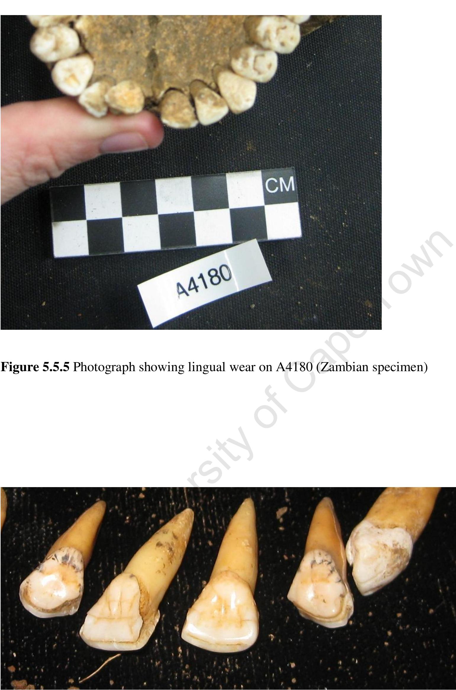 5.6. photograph showing maxillary central incisors of late