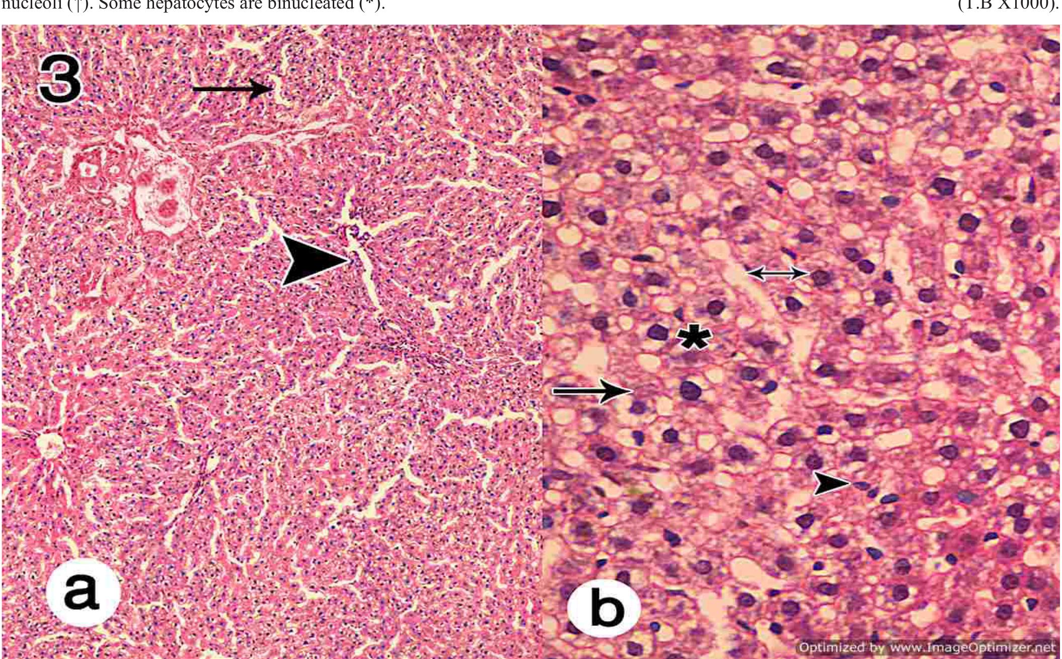 (3a): a photomicrograph of a section in the liver of ccl4