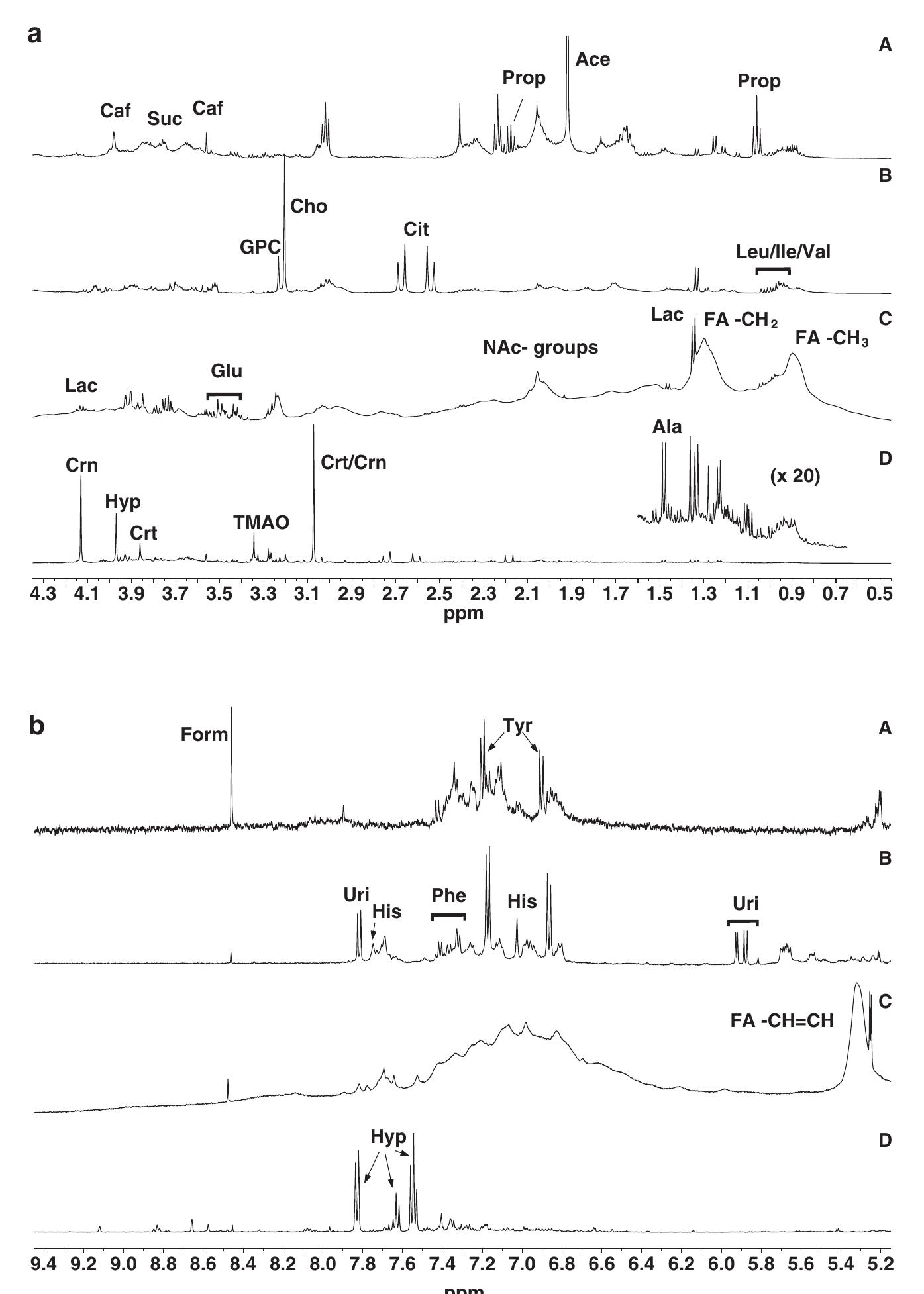 Typical 1h nmr spectra of (a) saliva, (b) seminal fluid, (c)