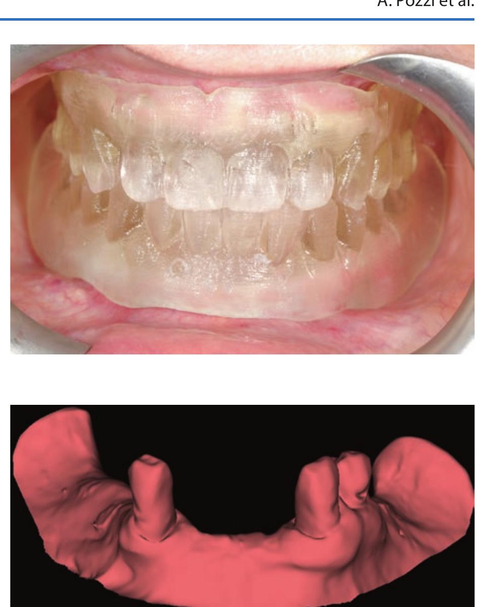 Libular arches) structures [11, 18]. the double-scan