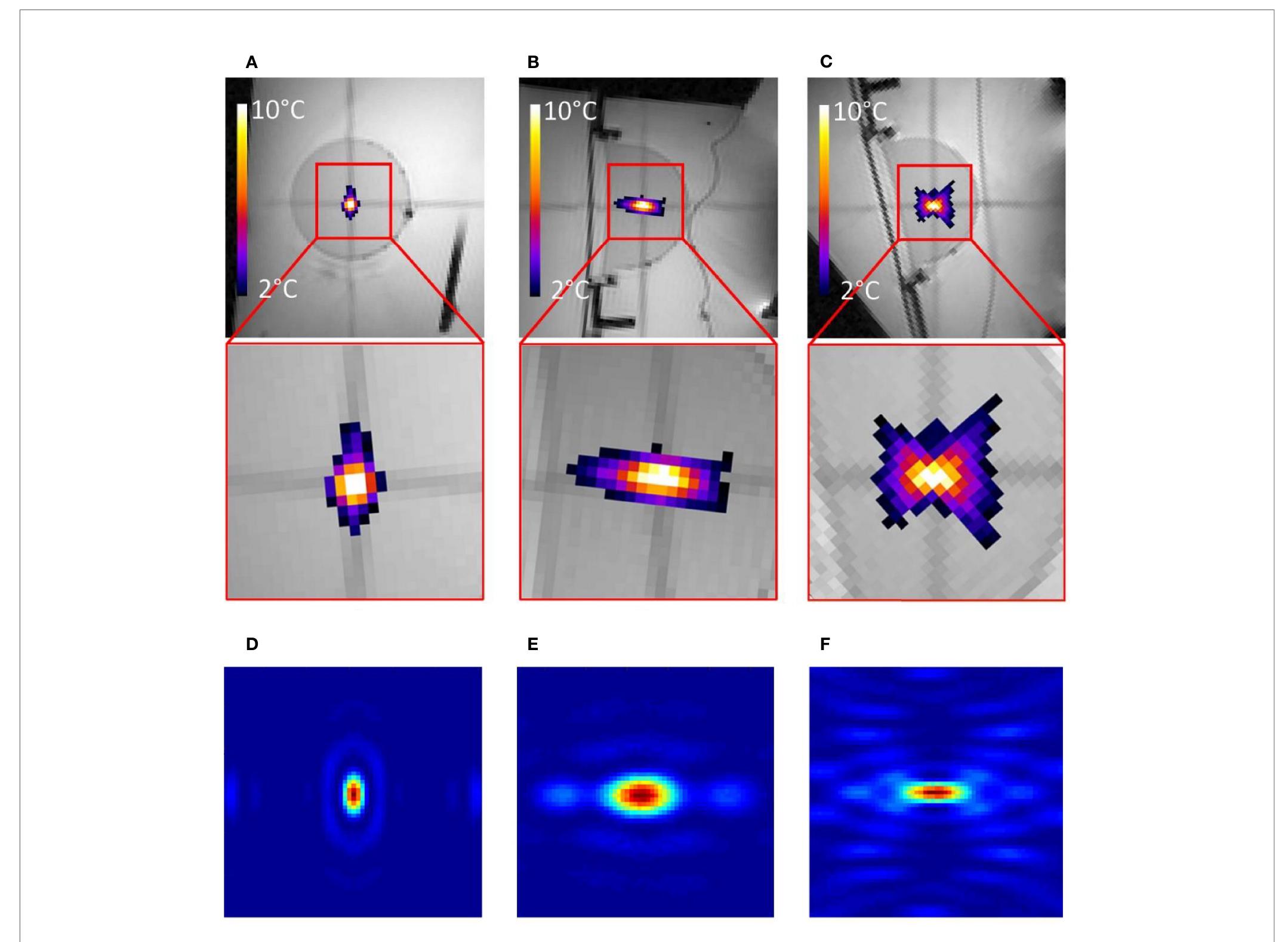 | (a-c) mr images of the gel phantom merged with proton