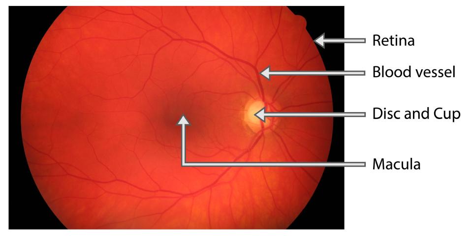 Labelled fundus image of a healthy eye.