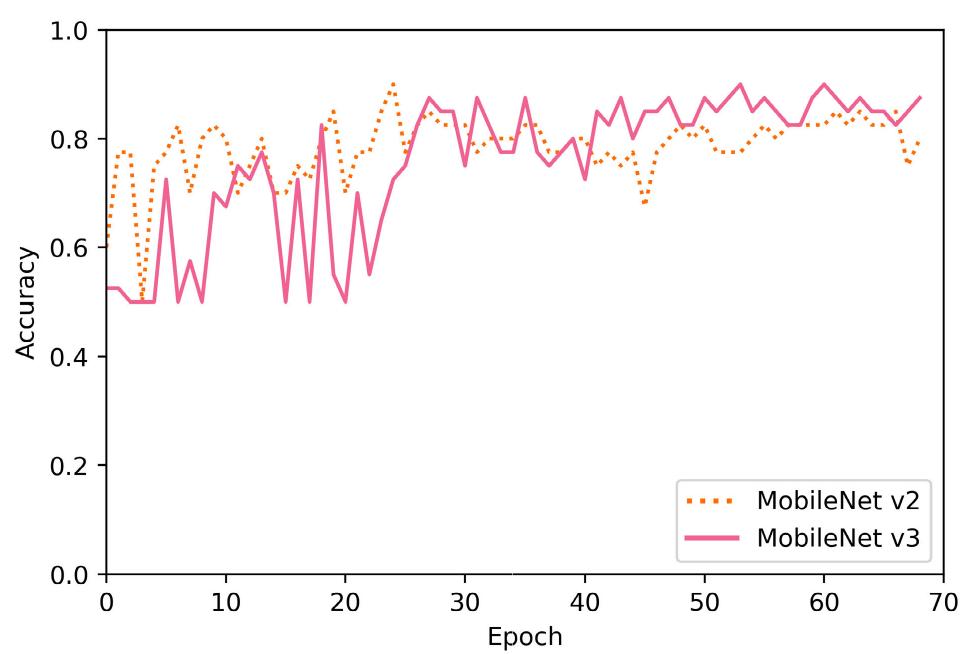 Figure 17 - Deep Learning-Based Glaucoma Detection With