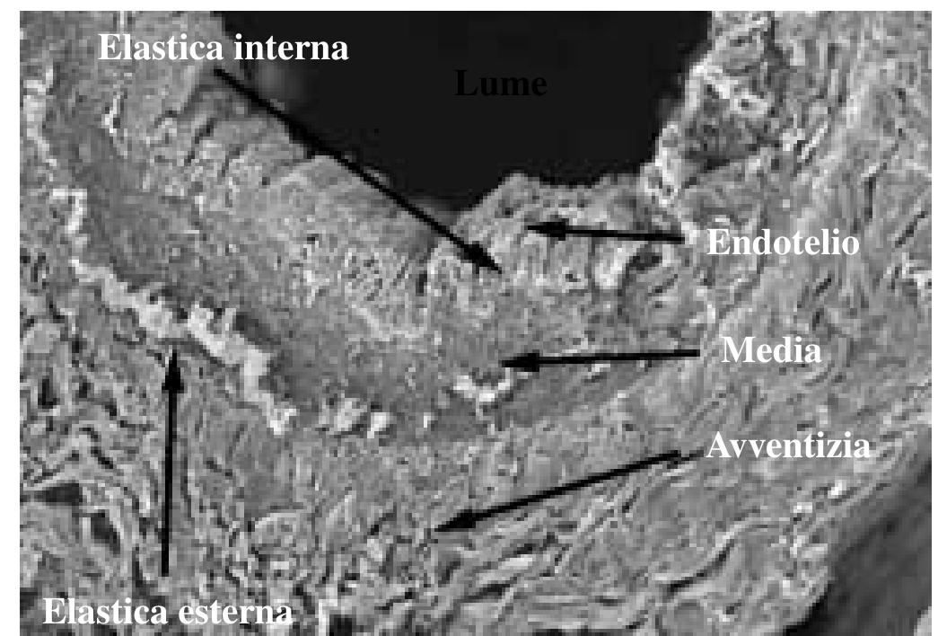 ‘igure 2.—three-layer structure of arterial wall
