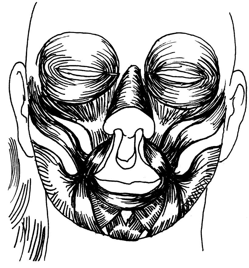 Bilateral cleft that shows insertion of the cleft ends of