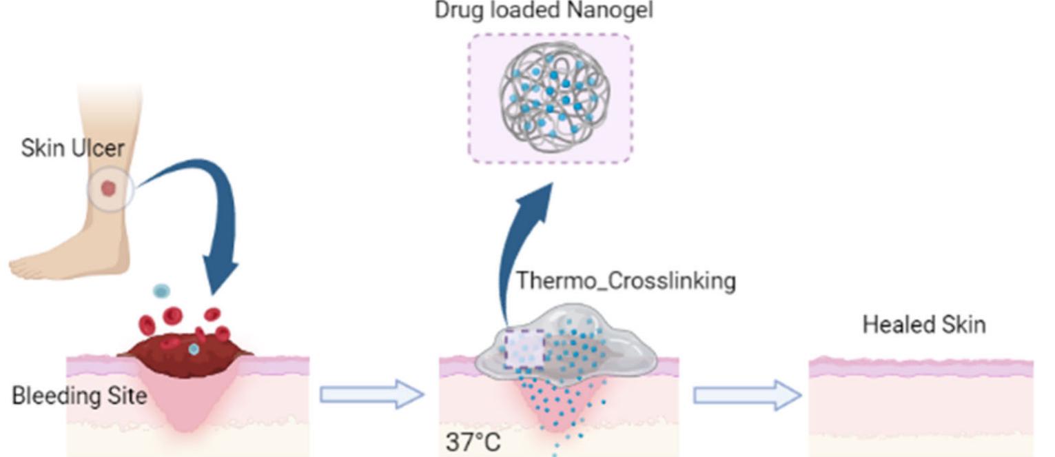 Preparation and application of drug-loaded nanogel hybrid