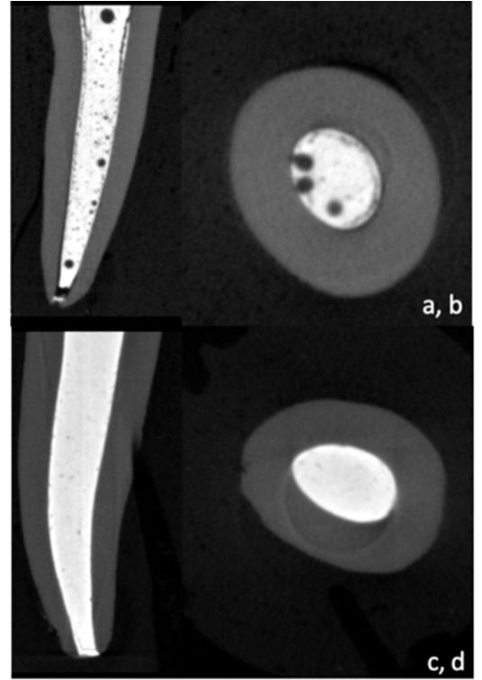 Micro-ct cross sections and reconstructed 3d image showing