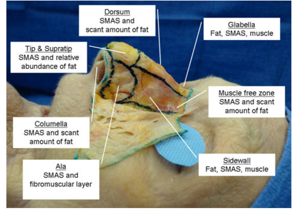 Superficial soft tissue composition of the nose according to