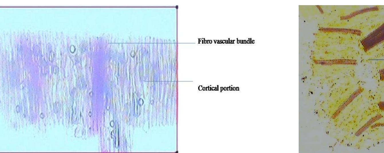 Transverse section of sepal (calyx) of tagetes erecta linn