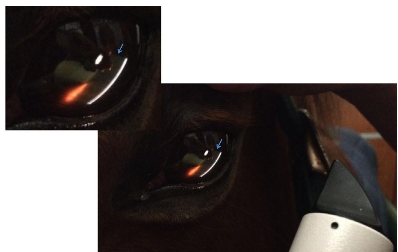 Examination of the anterior chamber showing aqueous flare.