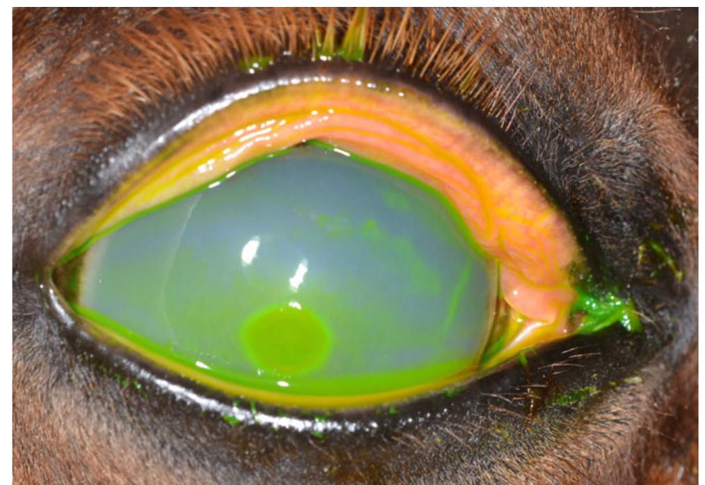 Superficial corneal ulcer stained with fluorescein. note the