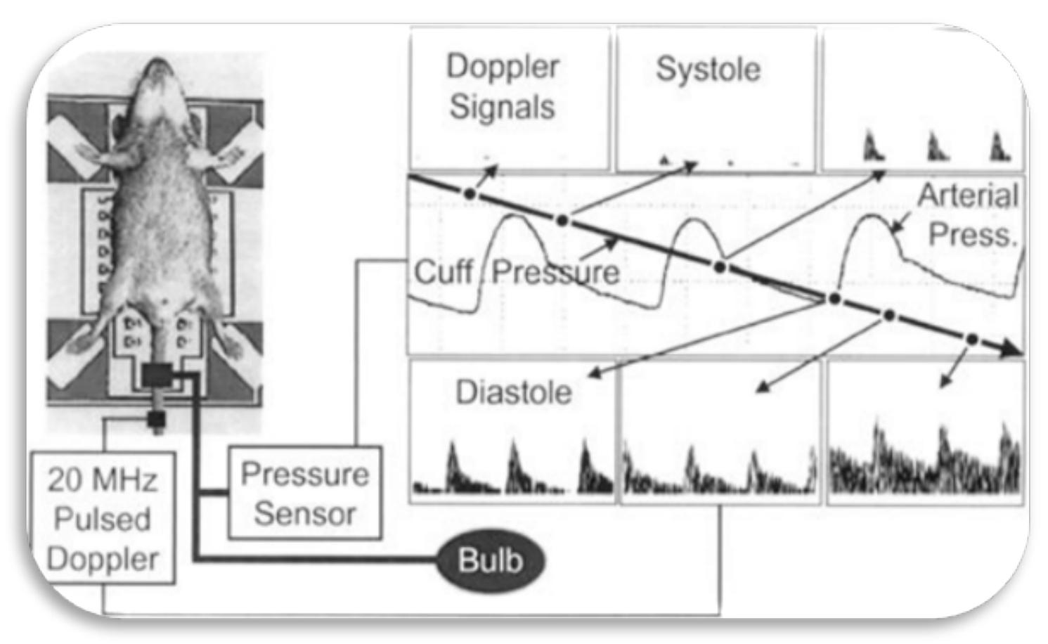 Illustration of how systolic and diastolic blood pressure