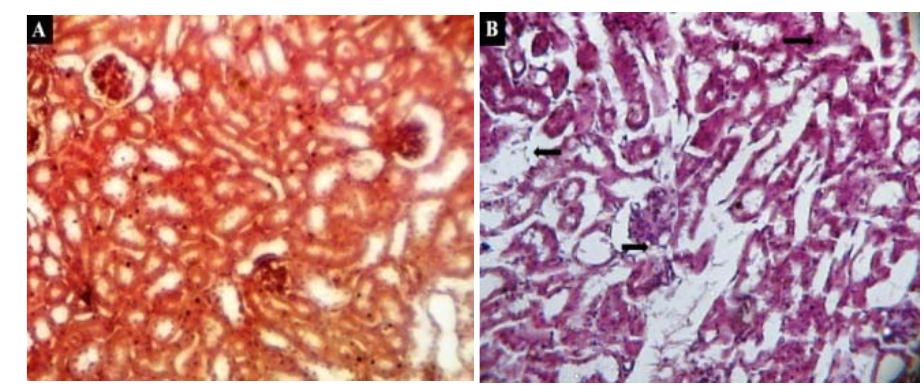 (a) control renal tissue shows normal architecture. (b)