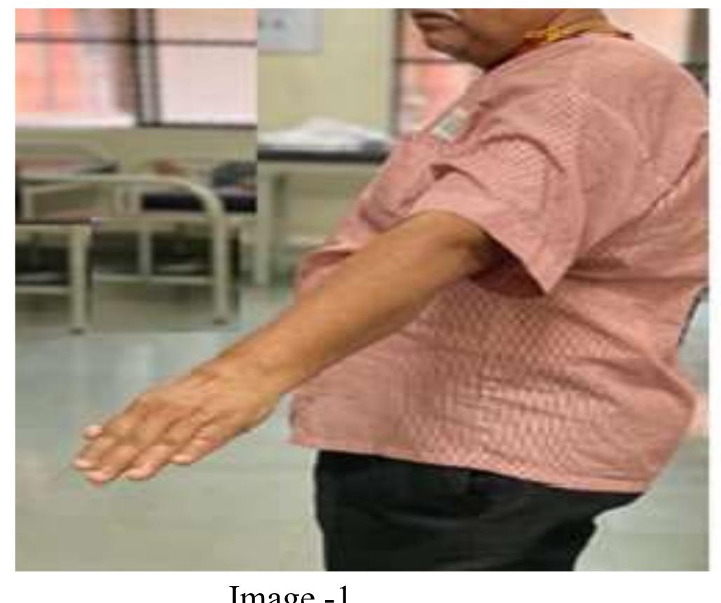 Before treatment :range of motion (restricted.)