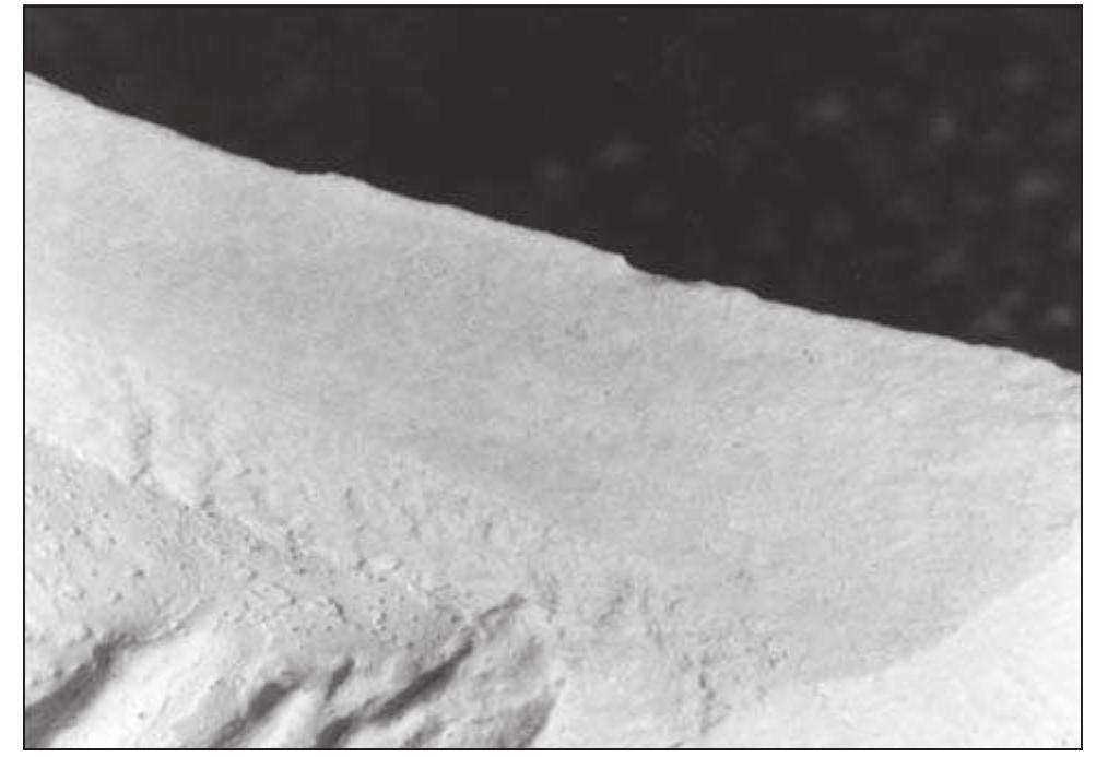 4. the very smooth fracture surface on a humerus broken