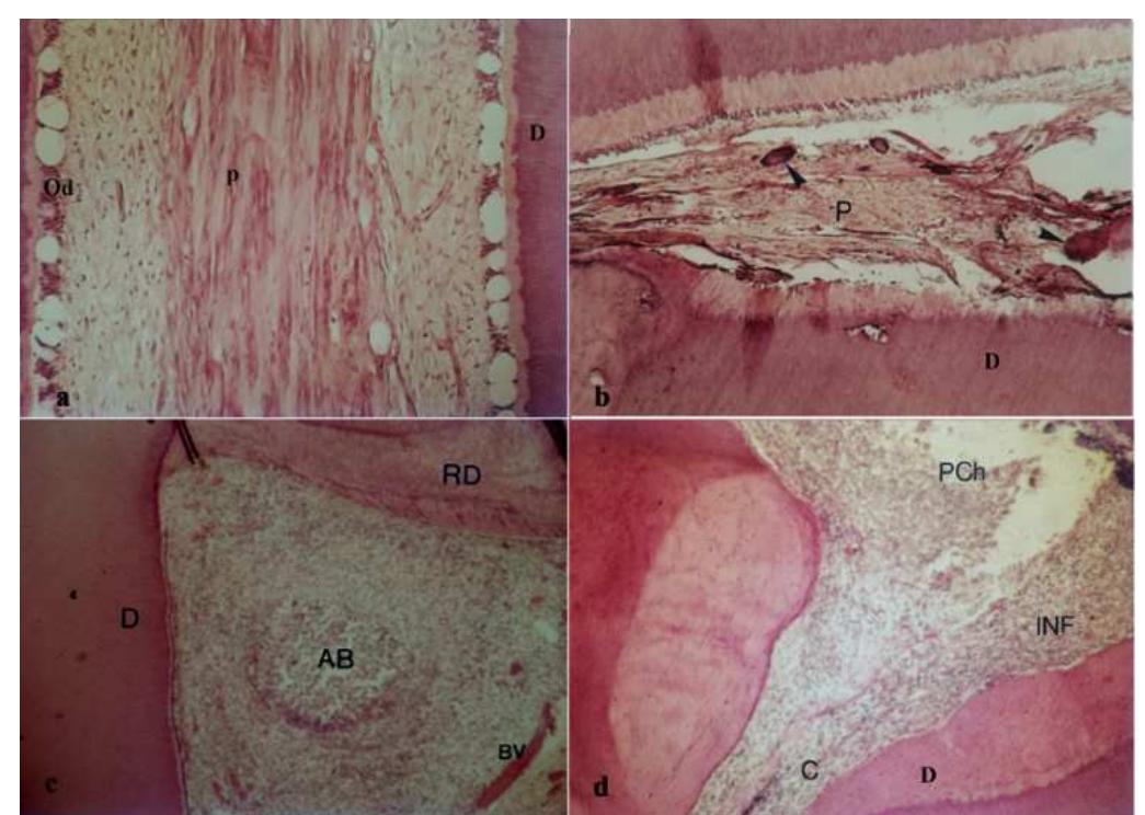 Different histological patterns of the pulp in teeth with