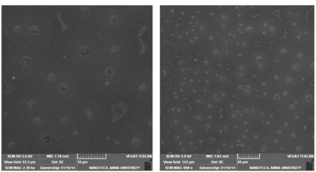 Sem micrographs of chitosan insulin nanoparticles