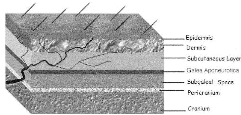 Cross-section of the scalp. note the location of the sub-