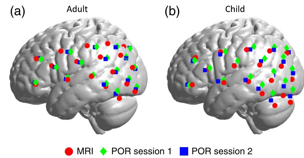Registration results of pre-mri, post-mri, mri registration