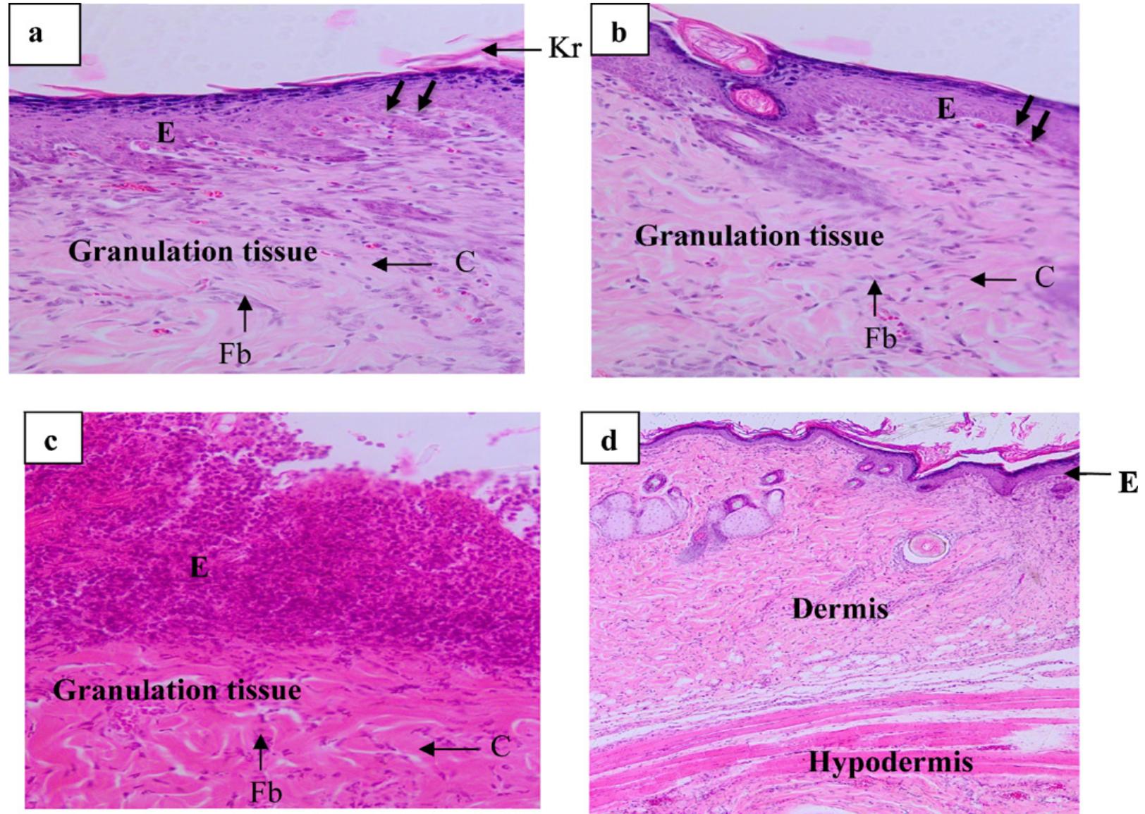 Photomicrographs showing section of skin tissues with h&e