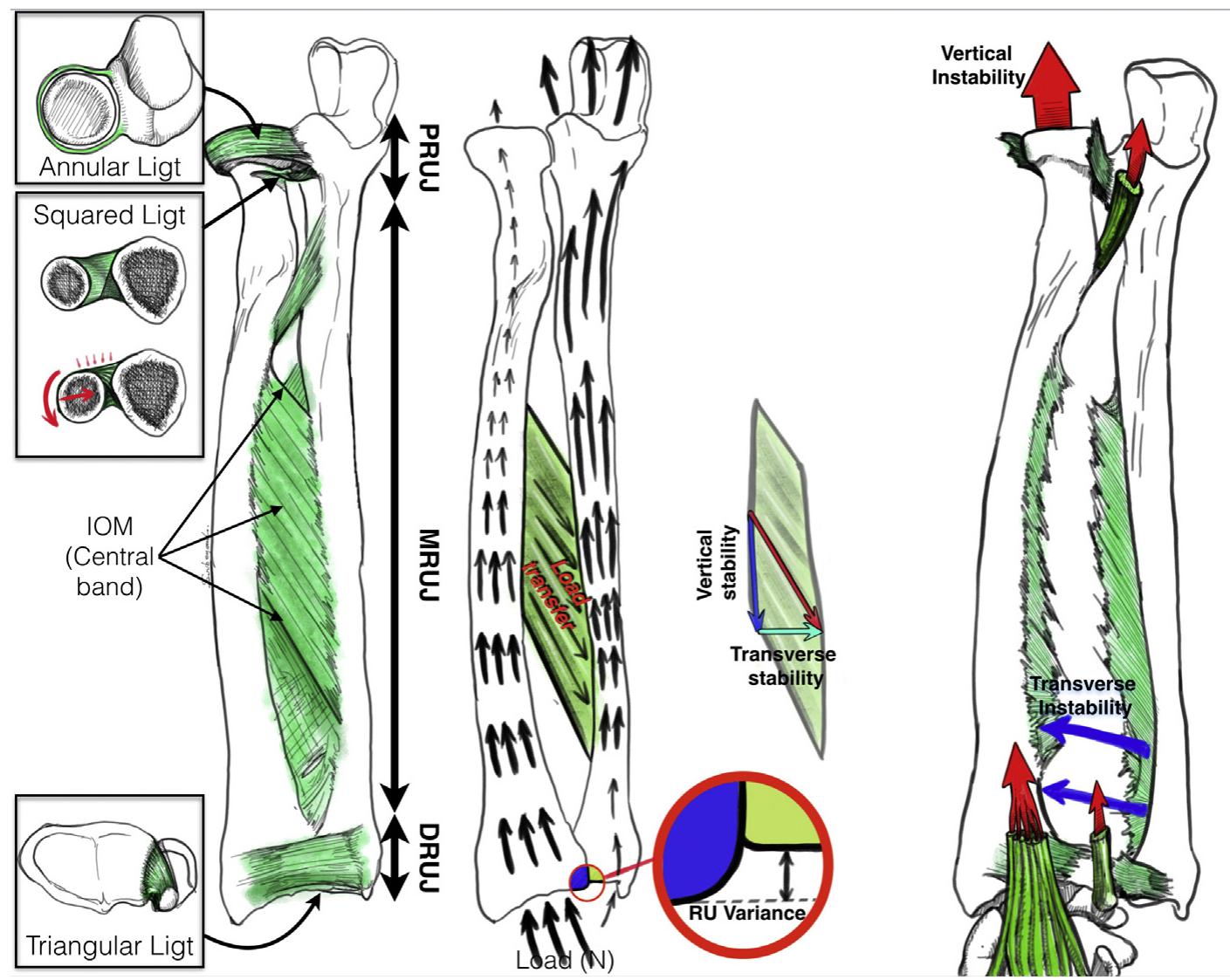 The three radioulnar joints, the forearm stabilizers and the