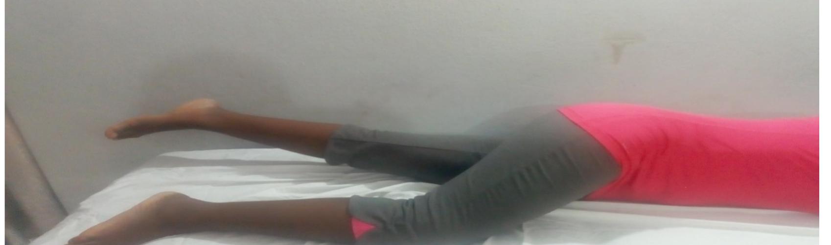 Plate 16. leg loading of adductor magnus and brevis in