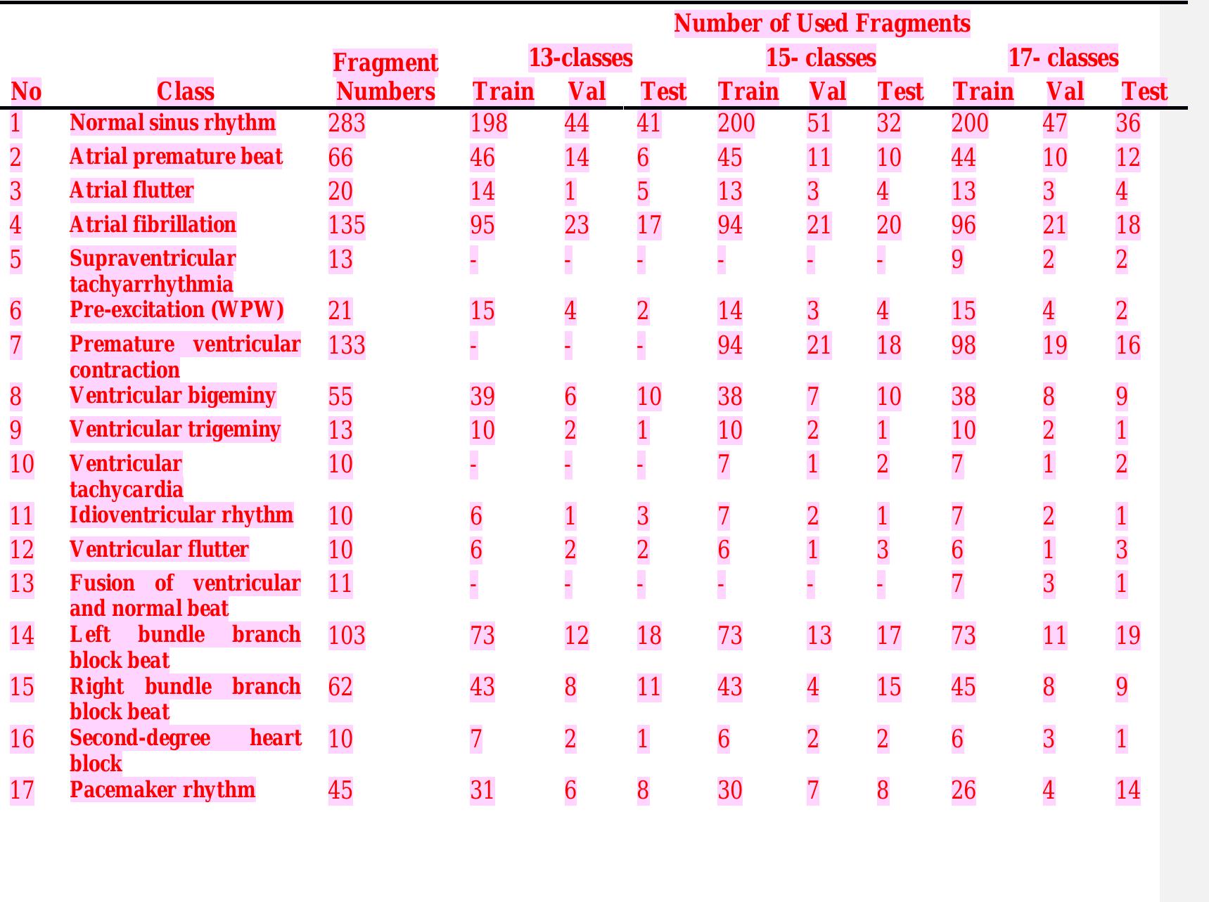 Sinus rhythm, pacemaker rhythm, and 15 types of cardiac