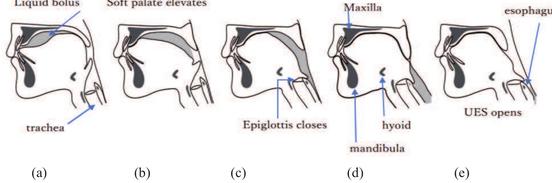 7 schematic images of a liquid swallow in lateral projection
