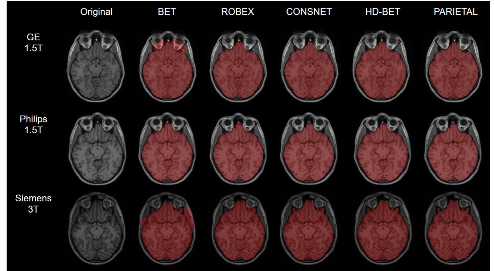 Qualitative examples of the in-house dataset from the same