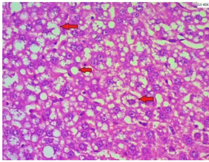G4 40x hande stain architecture of liver showing prominent