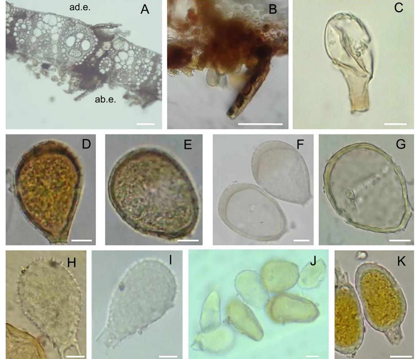 a) open pustules of puccinia kuehnii on abaxial and