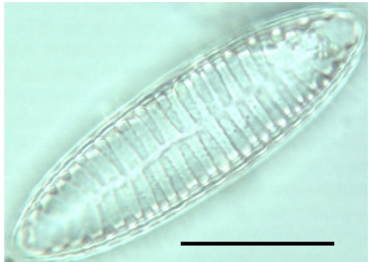 The diatom surirella angusta. scale bar: 20 micrometers. k.